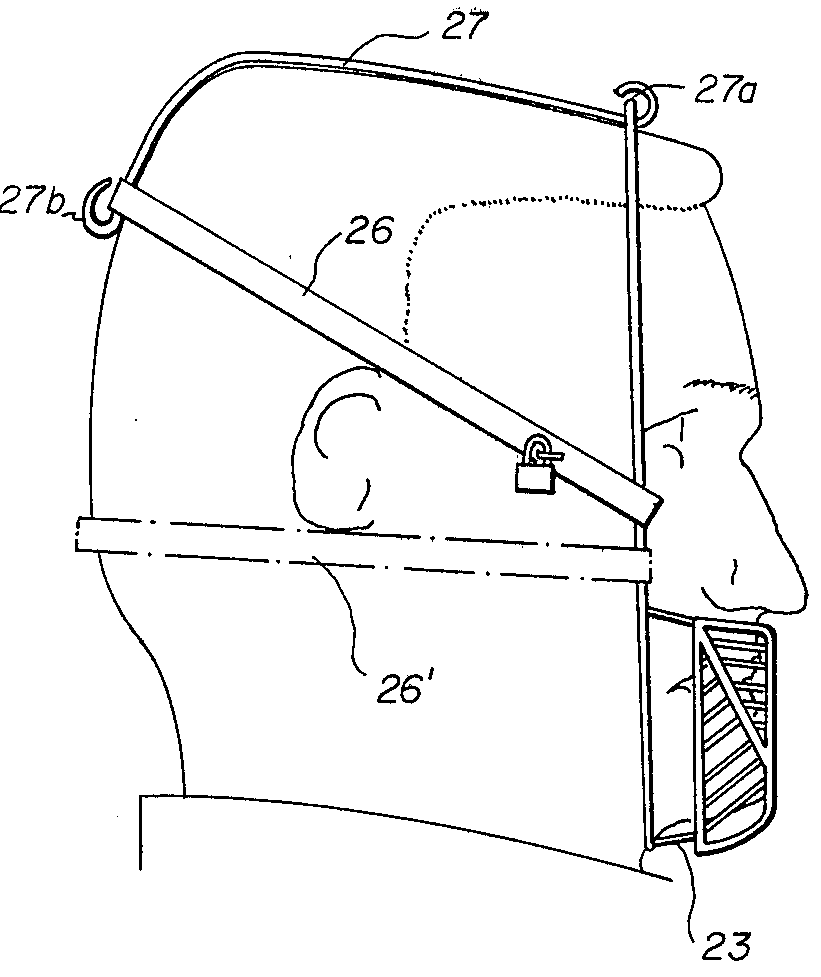 The Anti-Eating Face Mask – Patenting the odd, the impossible, and the ...
